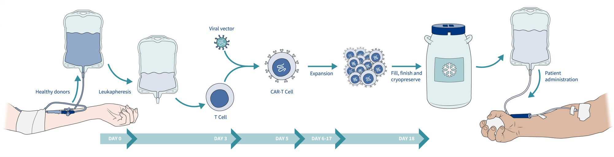 Allogeneic CAR-T Cells - Excellos